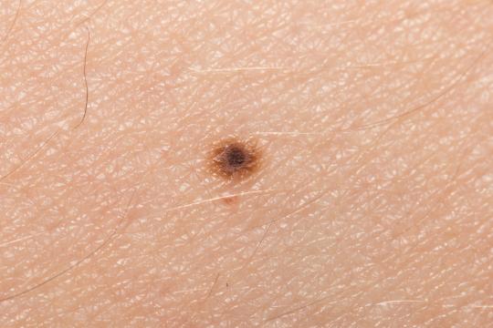 Thuisarts | Betrouwbare en onafhankelijke informatie van uw arts